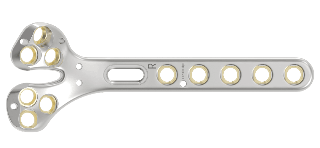 Bonebridge - SALGINA